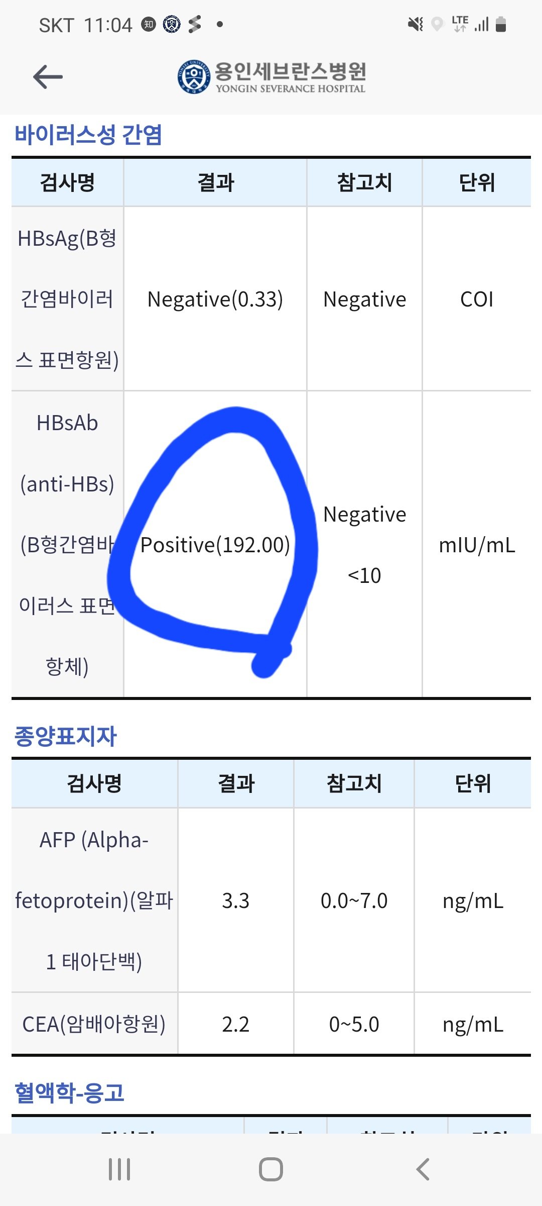Anti Hbs Anti Hbs