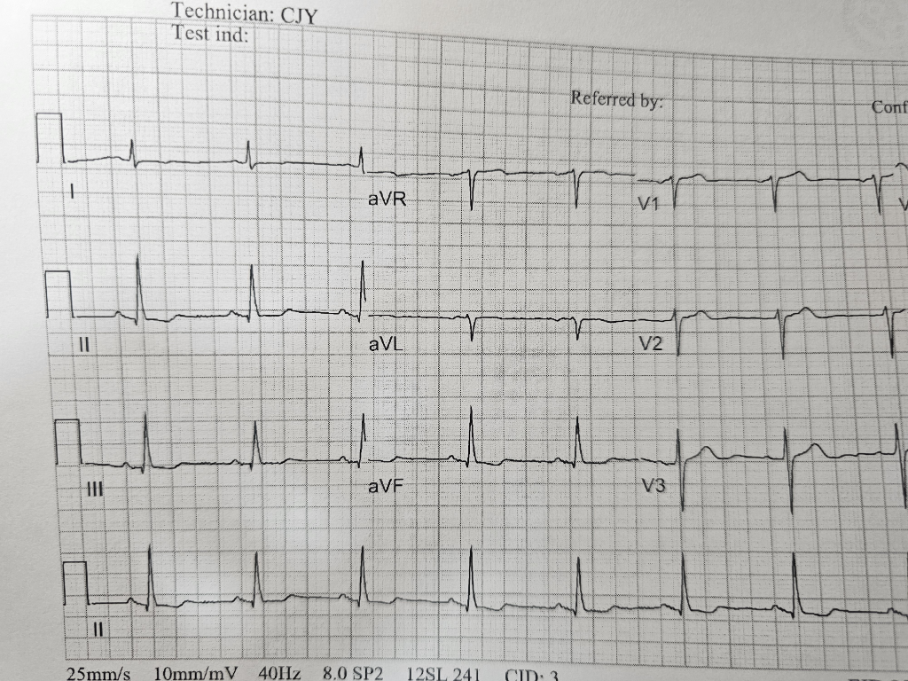 NSTEMI 진단 기준이 어떻게 되나요? 아래 자료가 진단기준에 부합한지 궁금합니다. ㅣ 궁금할 땐, 아하!